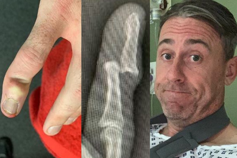 कैच के चक्कर में फील्डर के साथ बड़ा हादसा, टूटकर अलग हो गई हड्डी ...